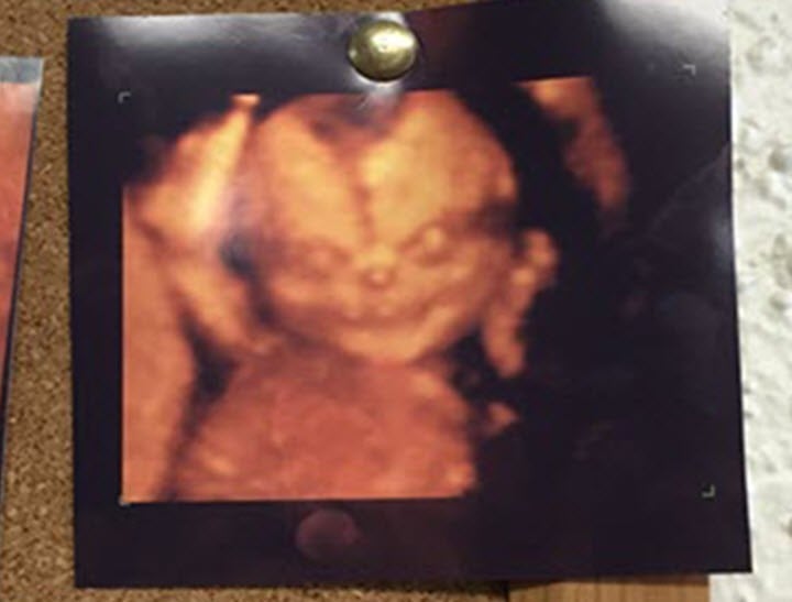 The creepy baby ultrasounds that prove children are devils.