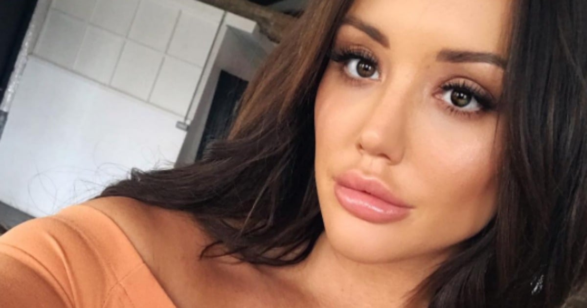 Why women are queuing up for a 'Facebook Facelift', according to experts.