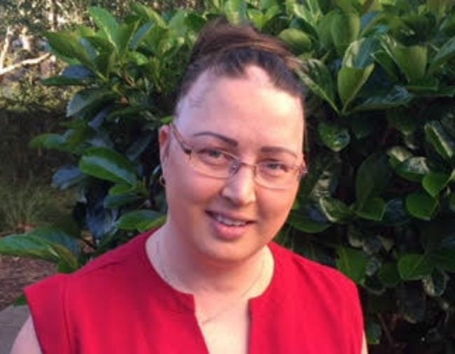 Female Hair Loss