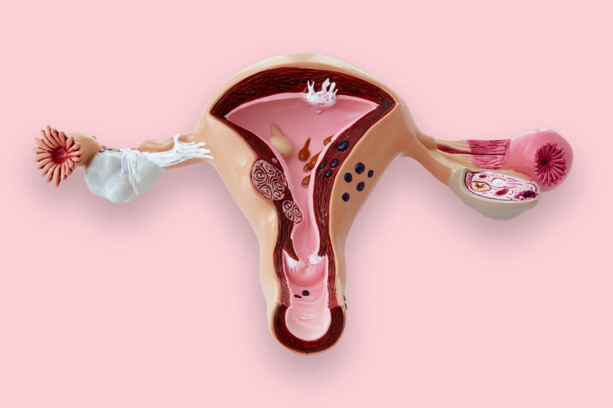 What Is A Hysterectomy A Farewell Letter To My Uterus 